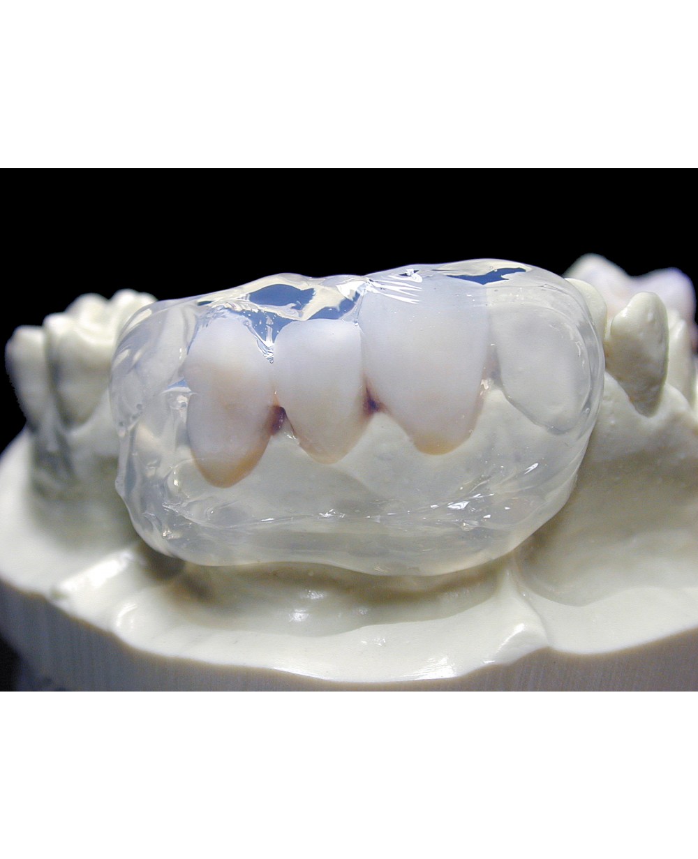 1 x 50ml Zhermack Elite Transparent