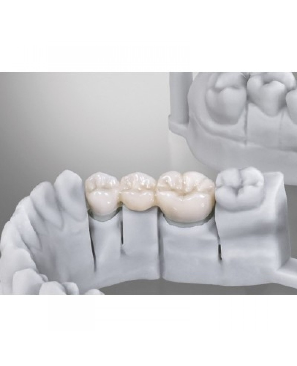 Detax Freeprint Model 385 Grey 1Kg