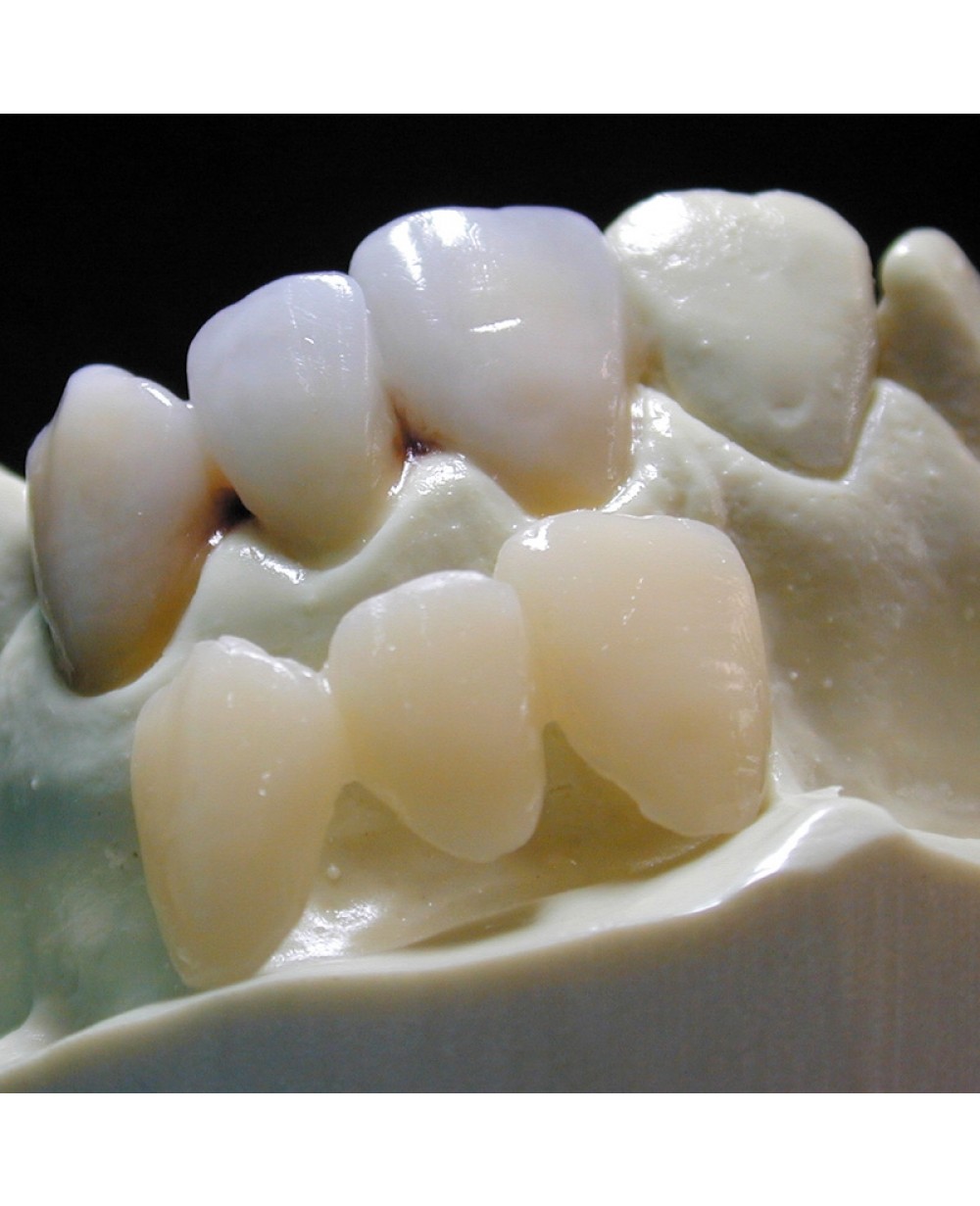 1 x 50ml Zhermack Elite Transparent