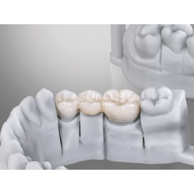 Detax Freeprint Model 385 Grey 1Kg